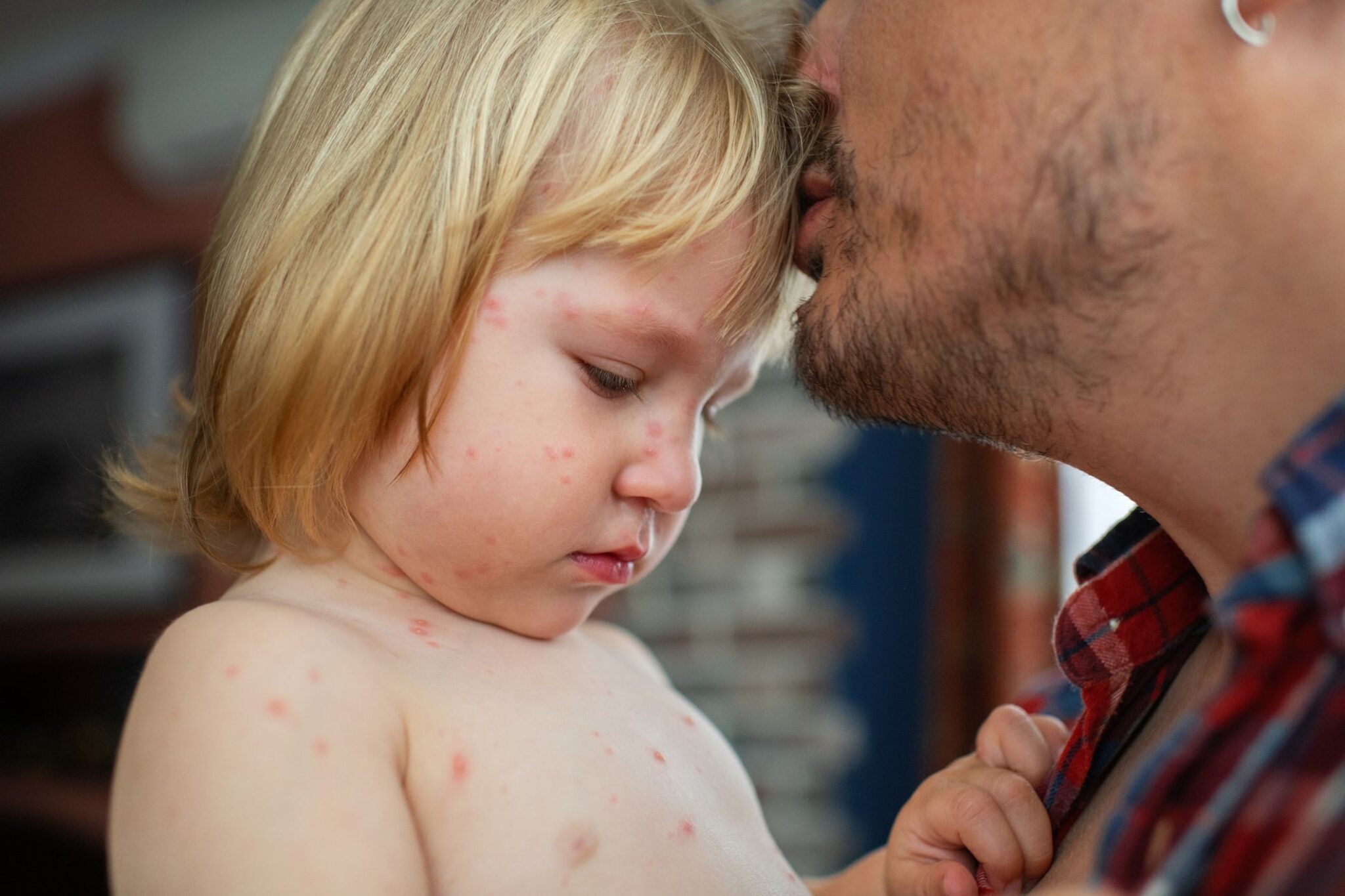 Sarasota Vasectomy Reversal- Center for Vasectomy Reversal